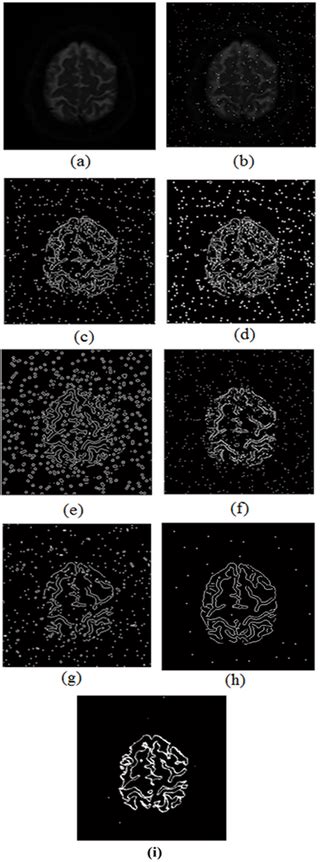 Fuzzy Logic Based Edge Detection In Smooth And Noisy Clinical Images
