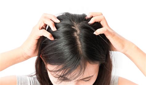 Understanding The Causes Of Different Scalp Conditions Curate Gifts