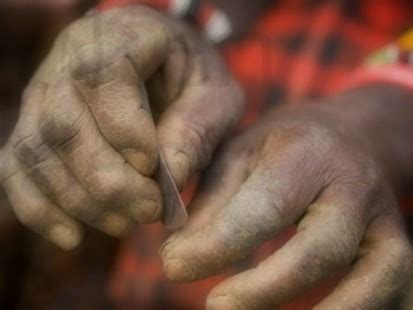 Female Genital Cutting Affecting Babe Girls In America ABC News