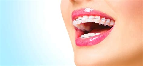 Orthodontics Australia What Is The Average Cost Of Braces In Melbourne