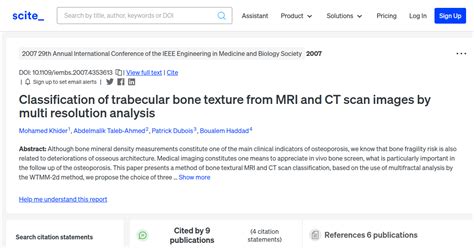Classification Of Trabecular Bone Texture From Mri And Ct Scan Images