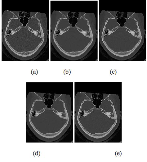 A Test Image 2 B Output Of Mf C Output Of Um At Optimum Amount λ
