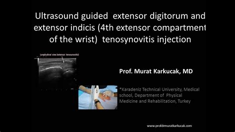 Extensor Tendonitis Injection At Francis Needham Blog