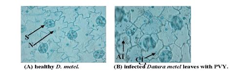 Light Micrography Of Epidermal Strips And Hairs Pvy Infected Datura