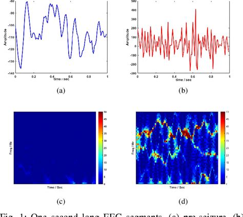Figure 1 From Epileptic Eeg Classification Using Synchrosqueezing Transform With Machine And
