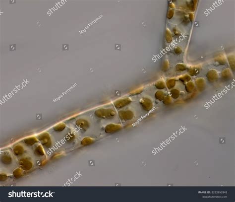 Brown Algae Under Microscope