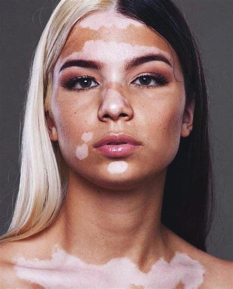 A Beleza Está De Volta 🌷s Instagram Photo A Comparação Vai Matar