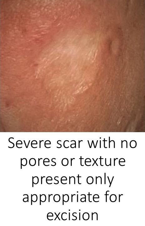 Scar Skin