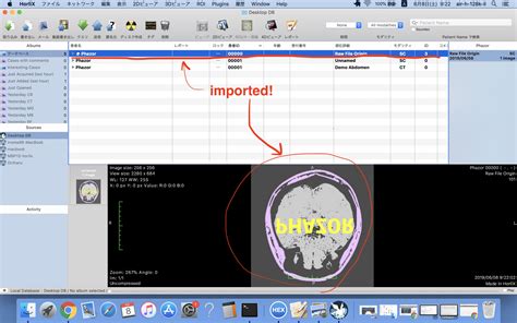 Dicom Results Segmentation Any Viewer Available Google Groups