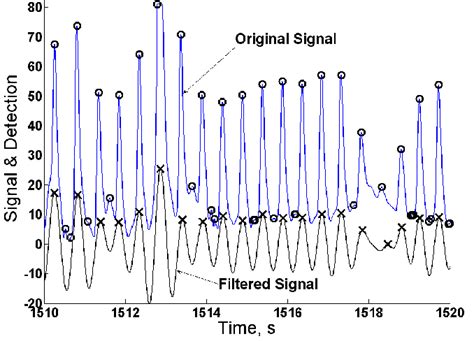 Figure 2 From Algorithm For Automatic Beat Detection Of Cardiovascular Pressure Signals