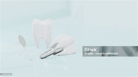 치과 임플란트 수술 개념 치과 의치 파란색 배경에 치과 의치 3d 렌더링 3차원 형태에 대한 스톡 사진 및 기타 이미지 3차원 형태 개념 개념과 주제 Istock