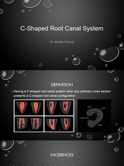 C Shaped Root Canal System Overview Pdf Dental Anatomy Tooth