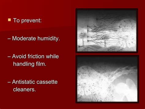 Radiograph Artifacts PPT