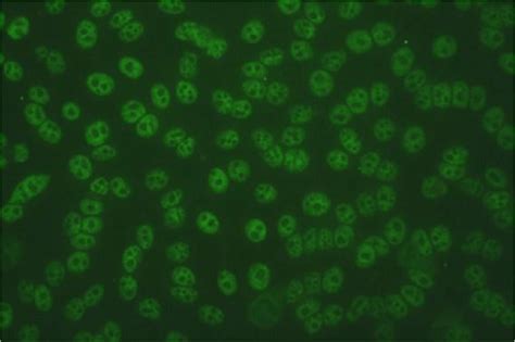 Indirect Immunofluorescence Staining Of Hep 2 Cells Exhibiting The Download Scientific Diagram