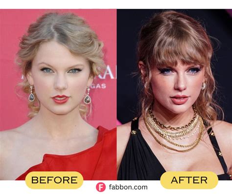 Did Taylor Swift Get Surgery Taylor Swift Plastic Surgery Comparison