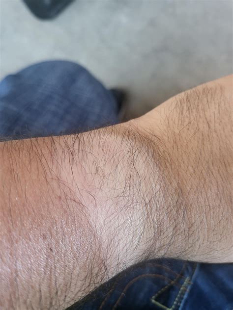 Working Cart Crew And Wearing A Watch In 90f Weather Will Give Ya A Tan Lol Rcostco