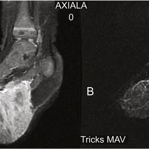 A Mri Identifying An Expansive Mass With Diffuse Contrast Download Scientific Diagram