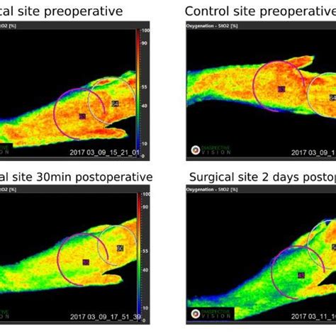 Rutherfords Classification Of Acute Limb Ischemia Download Table
