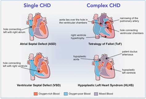 Cartoon Illustrating The Cardiac Structural Alterations In Common Download Scientific Diagram