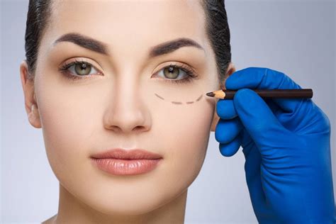 El Blog De Ceess ¿cuándo Se Da La Información Adecuada En Medicina
