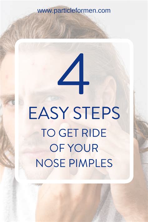 How To Get Rid Of Nose Pimples In Easy Steps Nose Pimples How To Get Rid Of Pimples Pimples