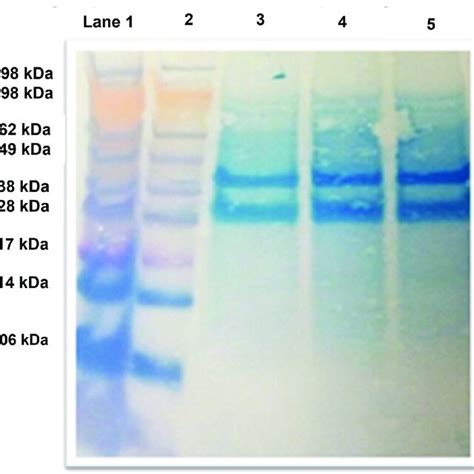 Ph Optimization Of Polyphenol Oxidase Isoforms Purified From The Fruit Download Scientific