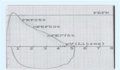 Pulmonary Function Test Download Scientific Diagram