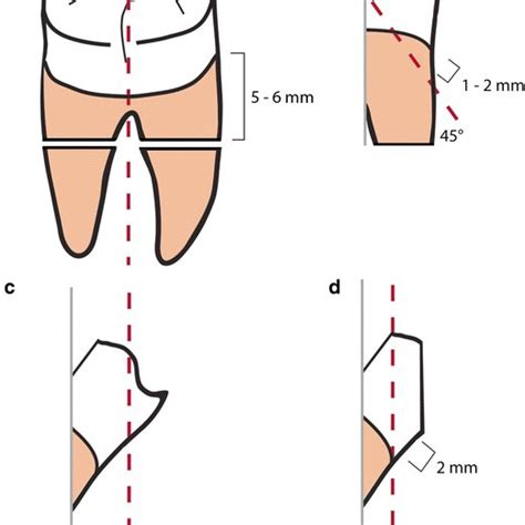 Tooth Specimen Preparation For Microhardness Testing A After The Root Download Scientific