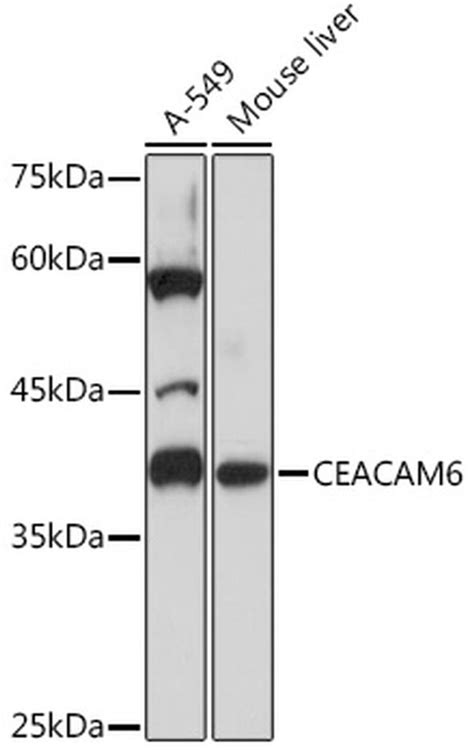 Ceacam6 Recombinant Monoclonal Antibody 4z3v7 Ma5 42880