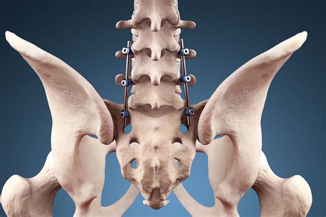 Jasons Story Pelvic Alignment Dynamic Spine And Neuropathy Chiropractor In Sioux Falls