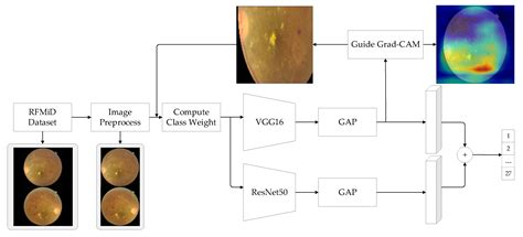 A Multi Label Detection Deep Learning Model With Attention Guided Image Enhancement For Retinal