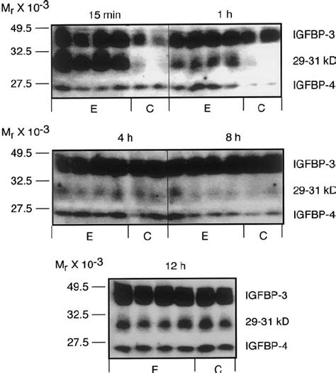 Plasma Igf Binding Protein Igfbp Profiles Of Food Deprived Control