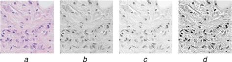 Different Images Obtained During Pre‐processing Steps A Download
