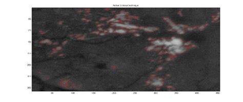 Active Contour Technique Applied For Abnormal Fundus Image Download