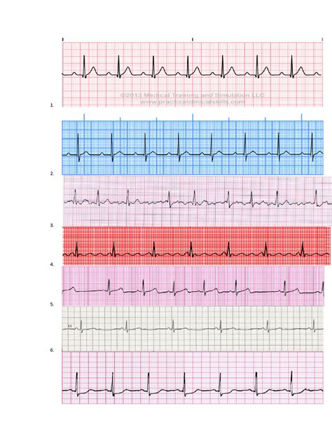 Heart Rate Calculation Pdf