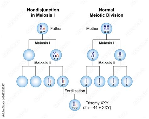 Trisomy Diagram