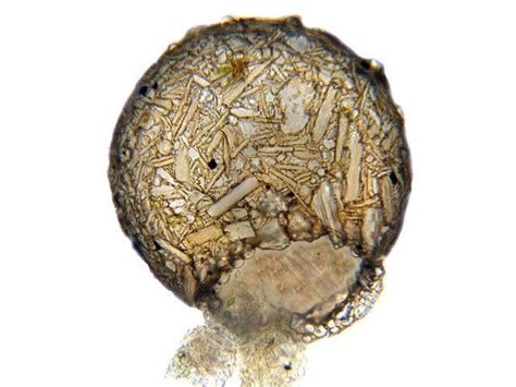 Difflugia Alchetron The Free Social Encyclopedia