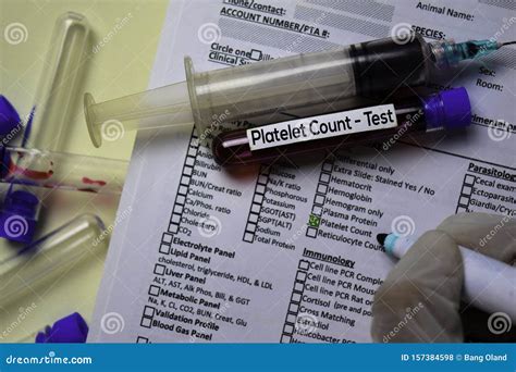 Platelet Count Test With Blood Sample Top View Isolated On Office Desk Stock Photo Image Of