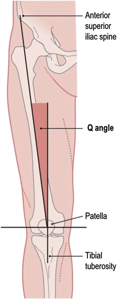 Q Angle From Porter S Dictionary Of Physiotherapy Philadelphia Download Scientific Diagram