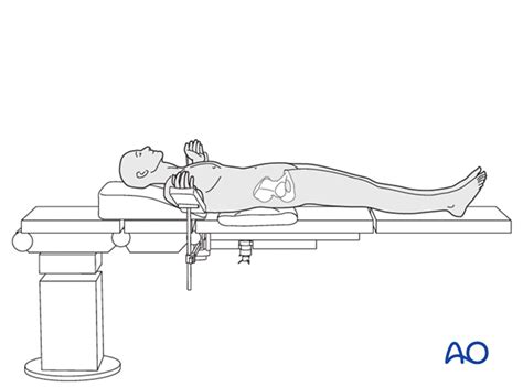 Supine