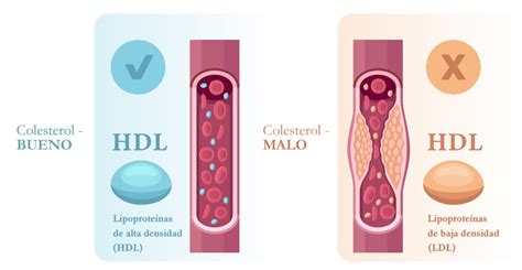 Colesterol Vldl ¿qué Es Y Su Importancia Para La Salud Salud
