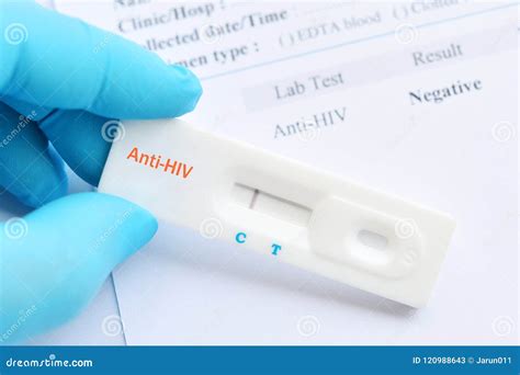 Conditions Of False Positive And False Negative Hiv Test