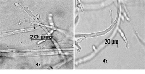 Table 1 From Morphological And Molecular Detection Of Fusarium Chlamydosporum From Root