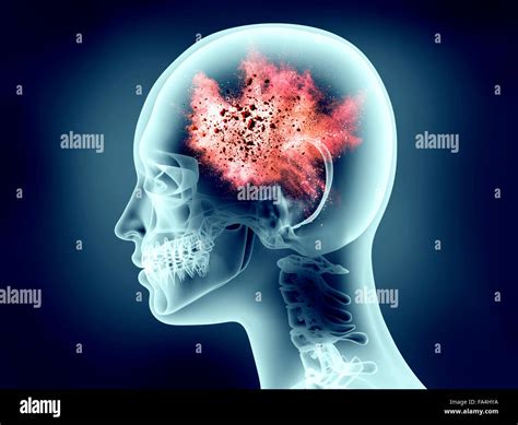 Brain Explosion Drawing