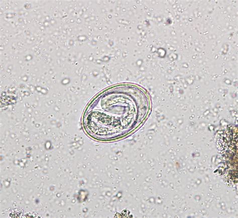 Ascaris Lumbricoides Decorticated Egg