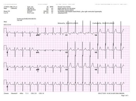 Cxr Findings In Cardiology Pptx Heart And Cardiovascular Diseases