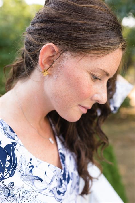 My Mohs Surgery Experience For Basal Cell Carcinoma Caitlin Houston