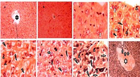Photo Micrographs In A Liver Section Of A Control Mice Showing Normal