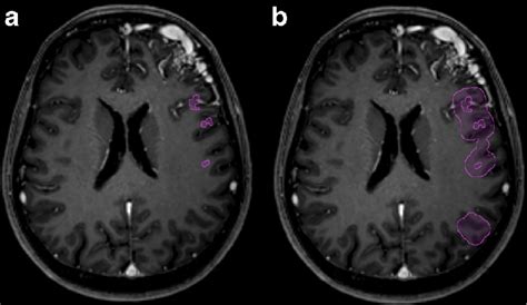 Creating Regions Of Interest Figure 1 Shows The Imported Ntms Language