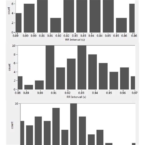 Statistic Analysis Of R R Interval Variation Over Each Of All Minutes Download Scientific
